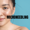 What To Put On After Microneedling? - https://microneedlingbeforeafter.com