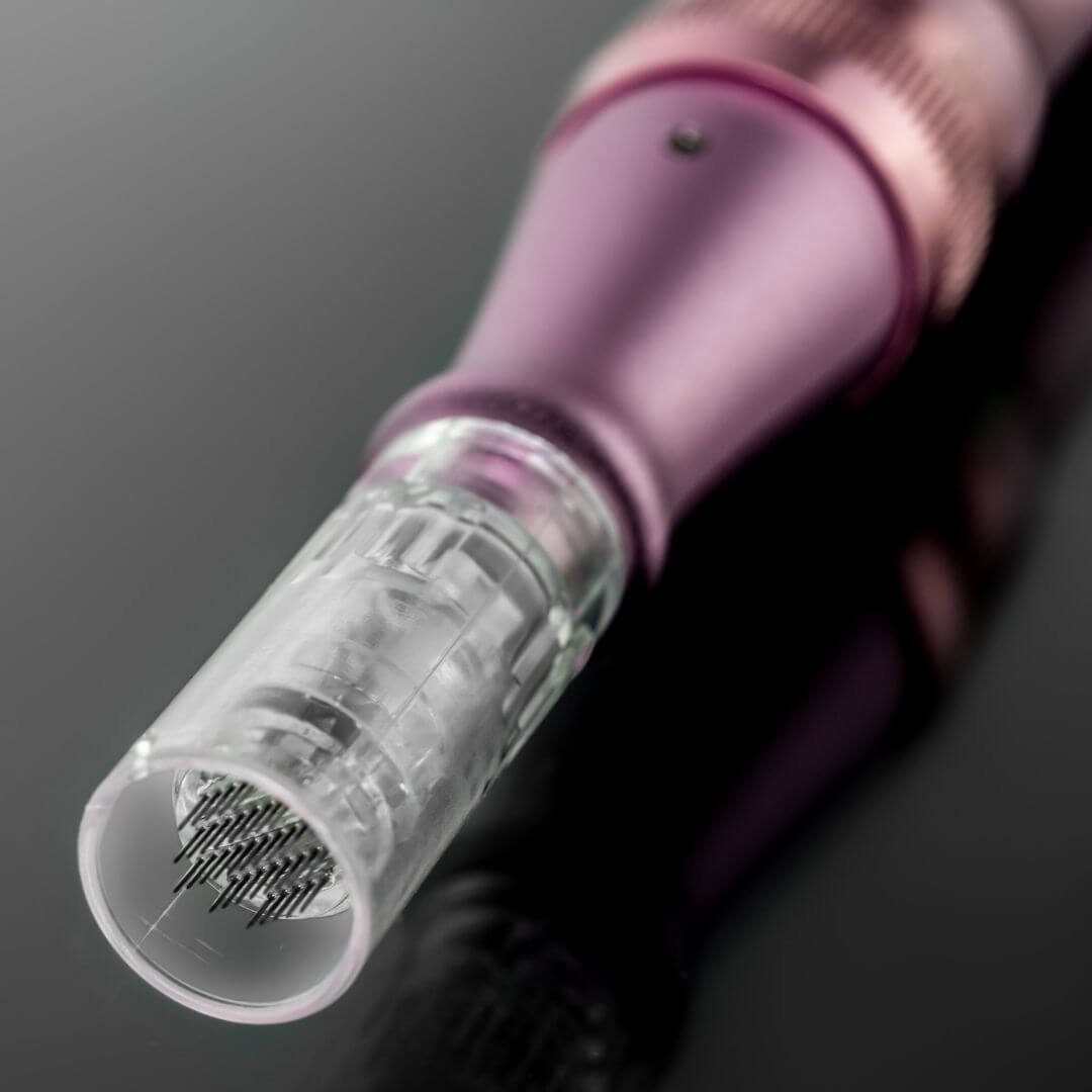 Can You Microneedle Your Lips? - https://microneedlingbeforeafter.com