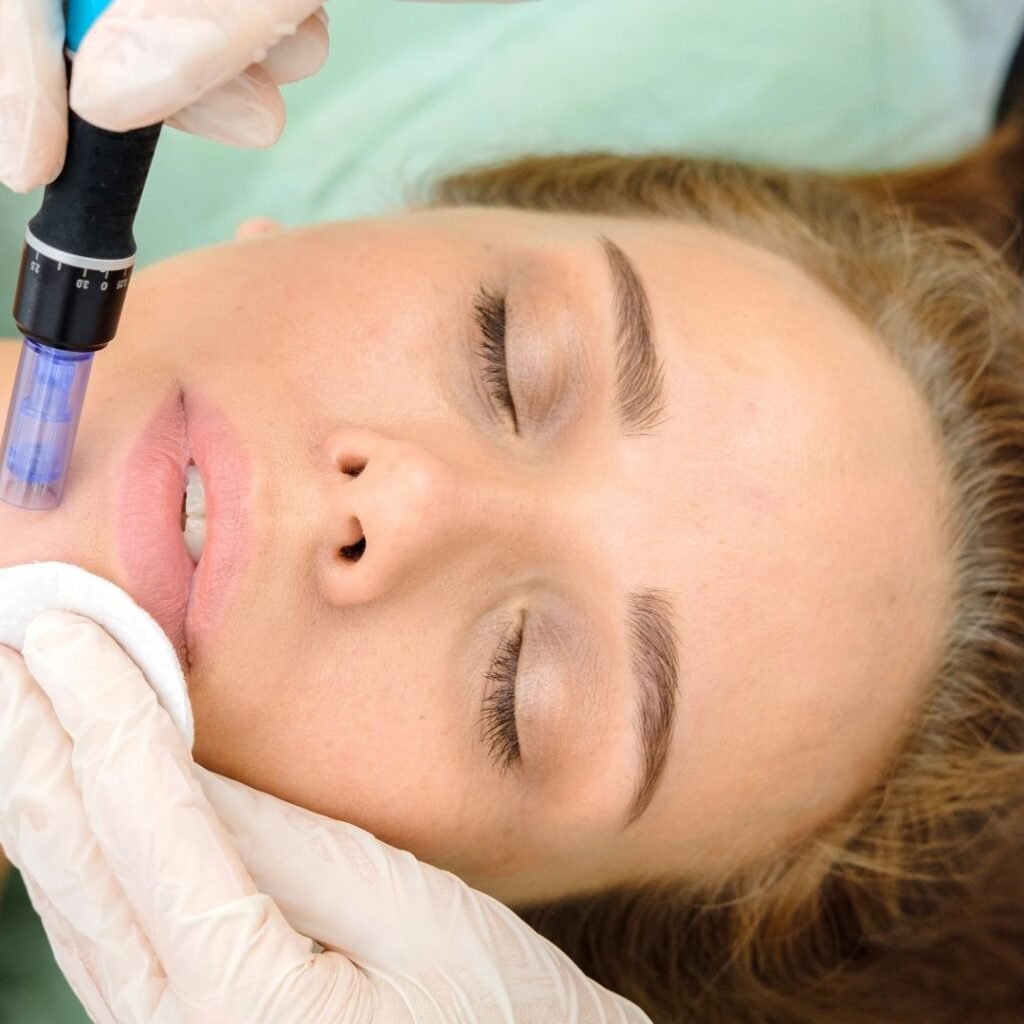 Pros And Cons Of Microneedling - https://microneedlingbeforeafter.com