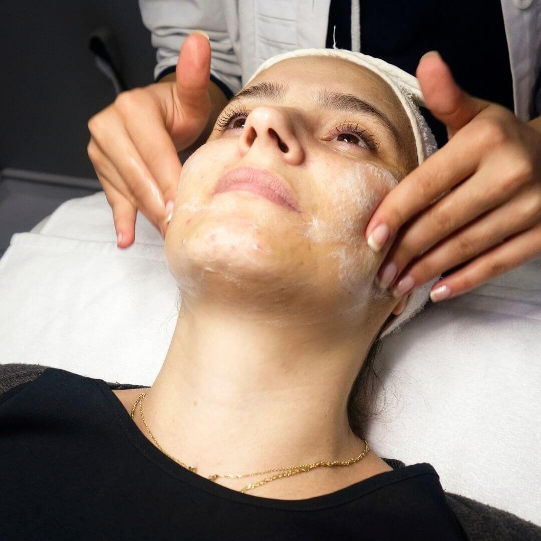Skin Looks Worse After Microneedling - https://microneedlingbeforeafter.com