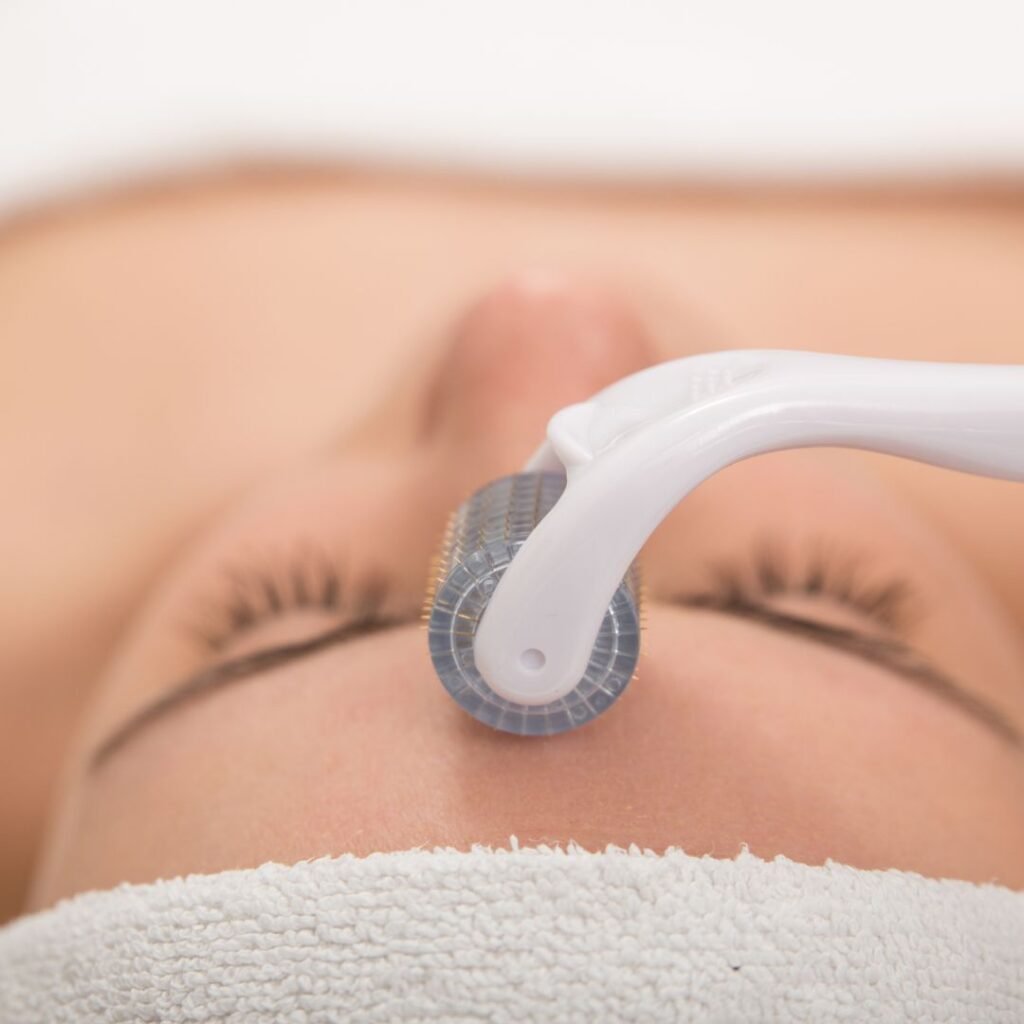 How Long Does Microneedling Results Last? - https ...