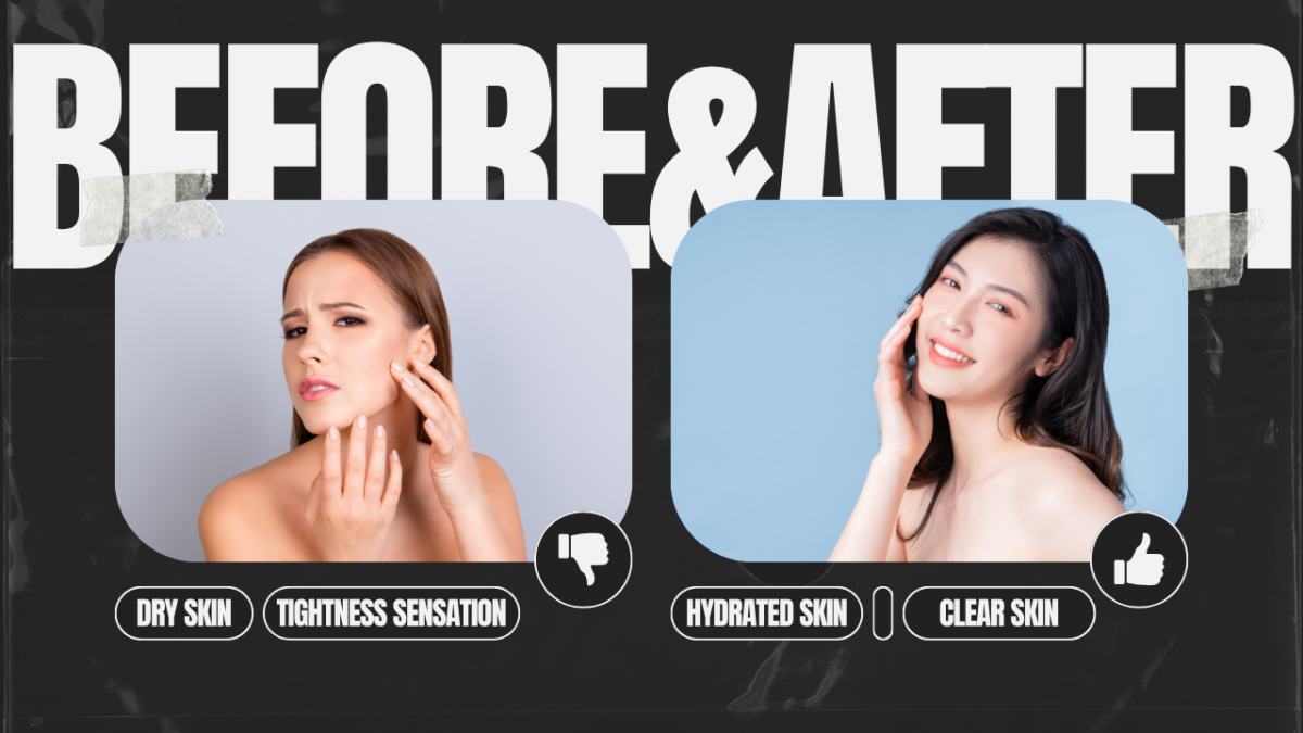 Microneedling BeforeAfter 101 Guide - https://microneedlingbeforeafter.com