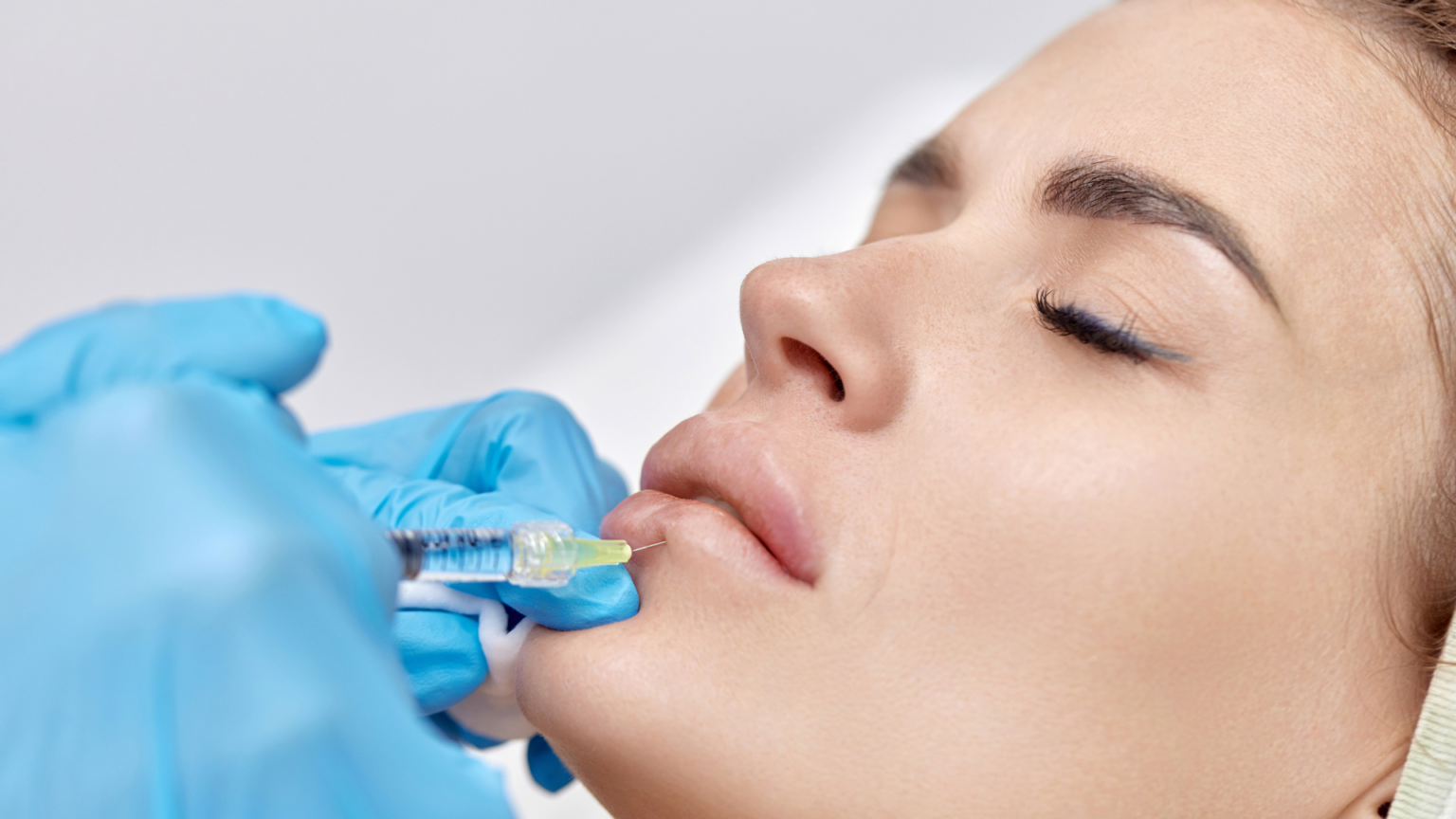 Is Microneedling On Lips Right For Me?