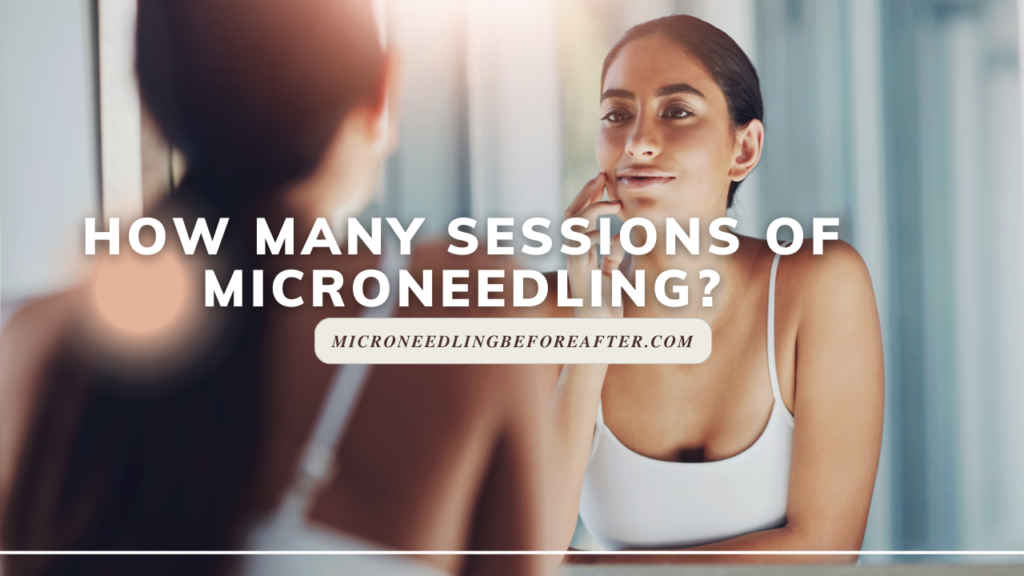 How Many Sessions Of Microneedling? - https://microneedlingbeforeafter.com